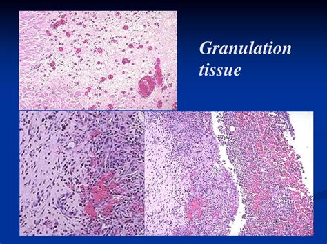 Injury Tissue And Cells Abrasion Tissue Loss Restore Ppt Download
