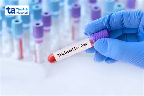 Chỉ Số Triglyceride Cao Là Bao Nhiêu Xét Nghiệm Và Cách Phòng Ngừa