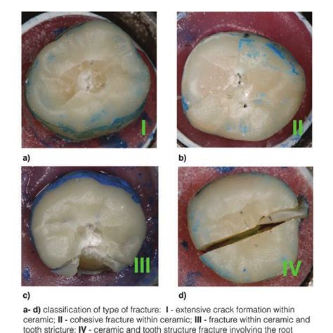 Classification Of The Mode Of Fracture Download Scientific Diagram