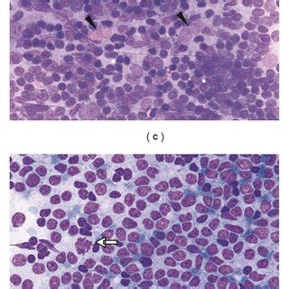 Pdf Diagnosis Of B Cell Non Hodgkin Lymphomas With Small