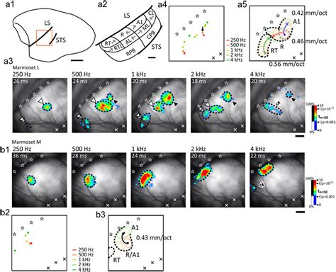 Core Areas Identified With Early Responses To Lower Frequency Tones A1 Download Scientific