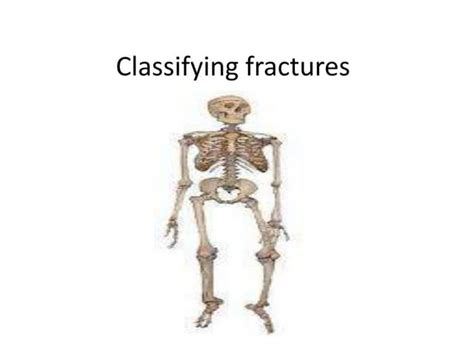 Classifying Fractures Pptx