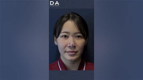 ХАМРЫН МЭС ЗАСЛЫН БОДИТ ӨӨРЧЛӨЛТ Youtube