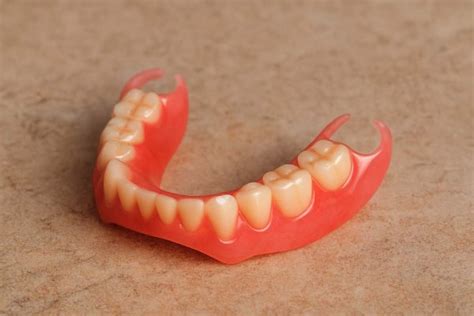 Valplast Prostheses Modern Dental Prostheses Na Walang Metal Hook