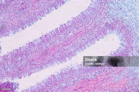 Slime Molds As A Group Are Polyphyletic Under The Microscope For