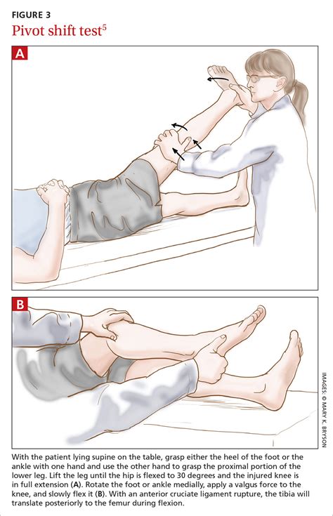 Lateral Pivot Shift Test Knee Lateral Pivot Shift Test Knee