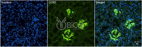 Ccr2 Cd192 Antibody Bicell Scientific®