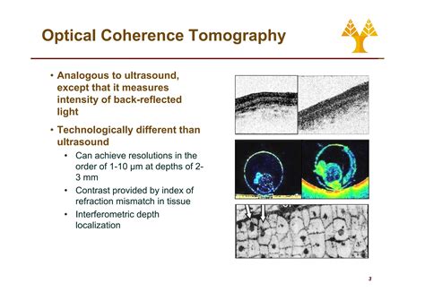 Optical Coherence Tomography Powerpoint Presentation Pdf