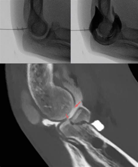 Arthrography Techniques Orthovellum