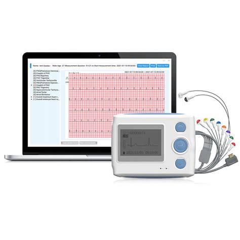 Ecg Monitor With Ai Analysis Wellue