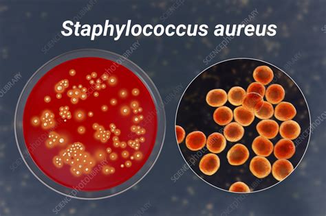 Staphylococcus Aureus Bacteria Illustration Stock Image F037 3656 Science Photo Library
