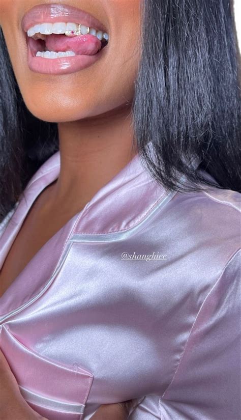 Pin By Getting My Life Together Diari On Collage Item Pins In 2024 Grills Teeth Dental