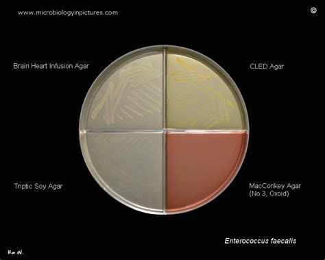 Comparison Of Growth Characteristics Of Enterococcus Faecalis On