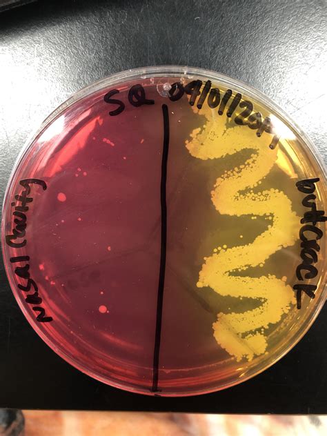 271 Best Msa Images On Pholder Metal Slug Attack Gasmasks And Snk