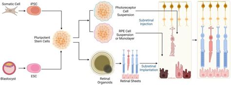 Gene Edited Retinal Organoids Restore Vision In Ird Jack Jie Huang