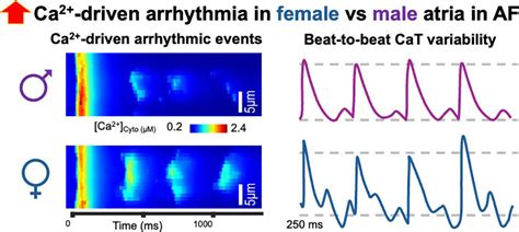 computational modeling uncovers key sex differences in common heart