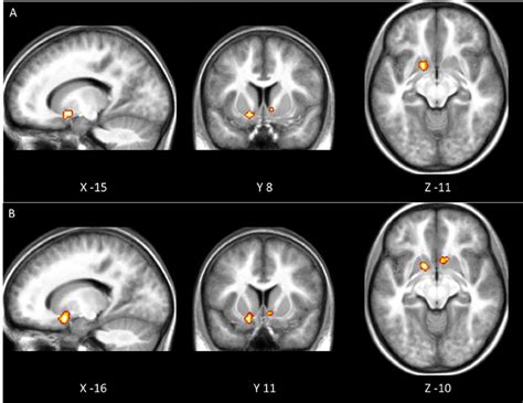 Ventral Striatal Activity Is Related To Task Performance There Was A Download Scientific