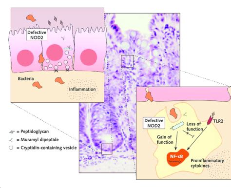 Proposed Functional Significance Of Nod2 Mutations In Crohn Disease