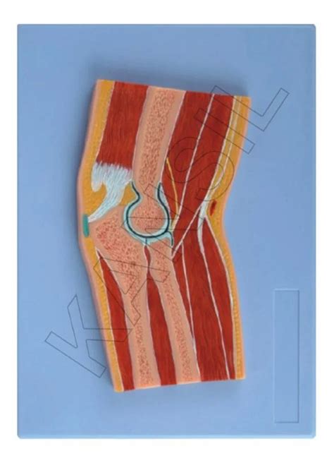 Elbow Joint Section Model At Rs 690900 Human Elbow Joint Model In