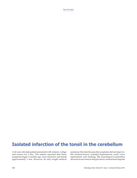 Pdf Isolated Infarction Of The Tonsil In The Cerebellum