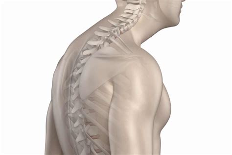 Reverse Kyphosis In Adults Matthew D Hepler Md