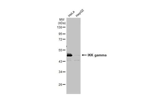 Ikk Gamma Monoclonal Antibody Hl1577 Invitrogen 100 μl Unconjugated