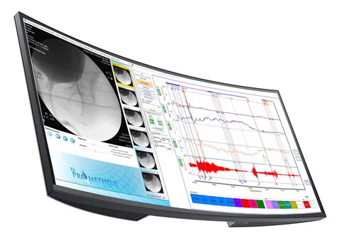 Morpheus® Office Urodynamics The Prometheus Group®