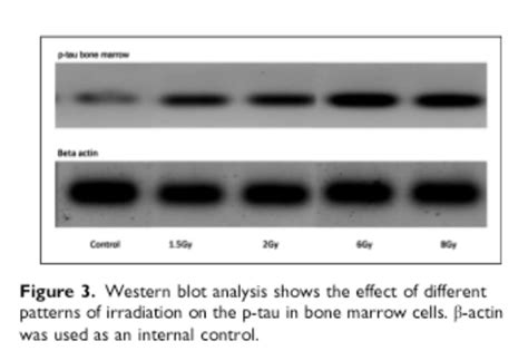 Western Blot Analysis Shows The Effect Of Different Patterns Of