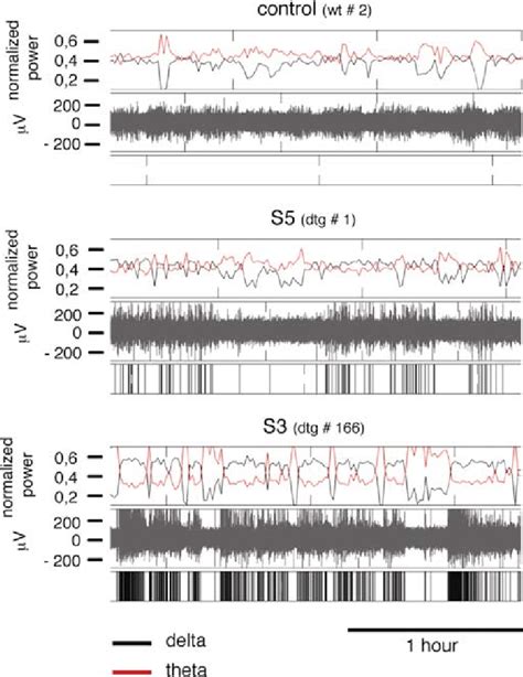Spectral Analysis Of Eeg Recordings About 2 H Of Typical Eeg