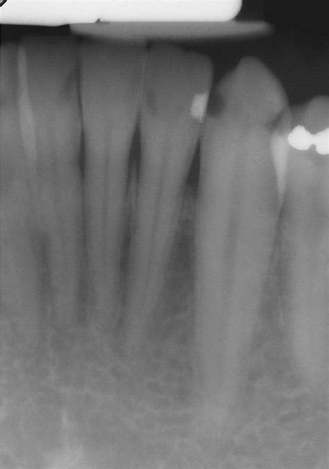 Silicate Cement Manufacturersupplierexporter