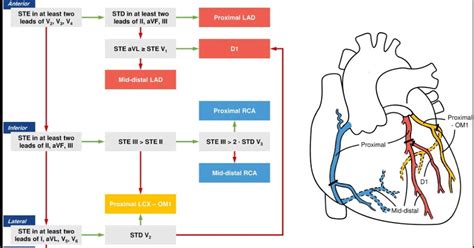 Localisation Of Infarct By Ecg