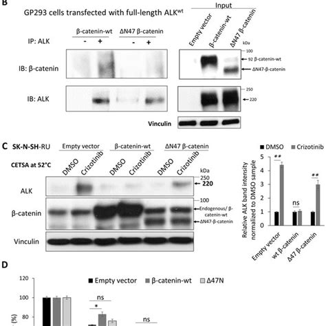Enforced β Catenin Wt Interacts With Alk And Abrogates Crizotinib Alk
