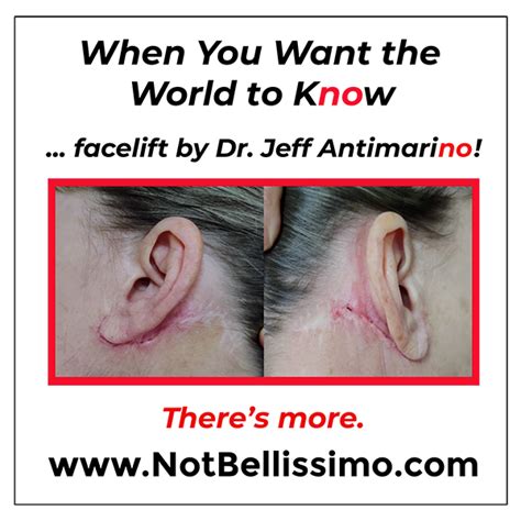 You Too Plastic Surgery Review And Results