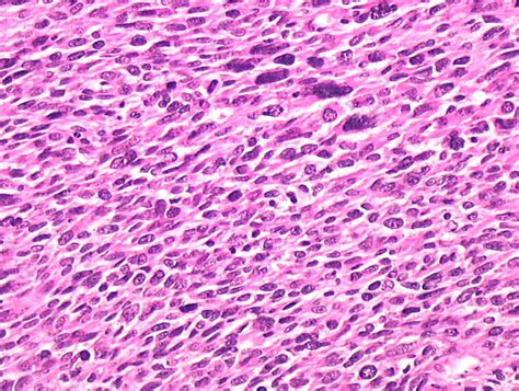 Histopathology Of The Uterine Cervix Digital Atlas