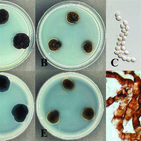 Morphological Characteristics Of Phaeophleospora Eucalypticola