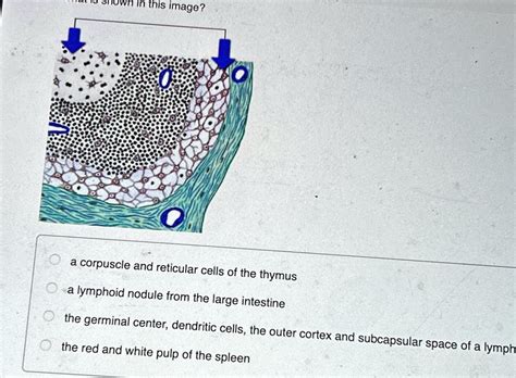 Shown In This Image A Corpuscle And Reticular Cells Of The Thymus A Lymphoid Nodule From The