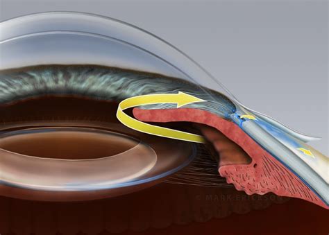 Aqueous Humor Pathways Eye Illustration Download