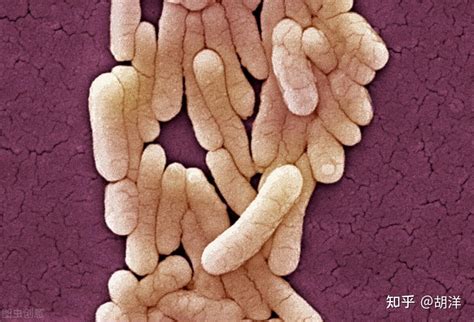 沙门氏菌污染污染的巧克力流入一百多个国家，吃了会有哪些症状 知乎