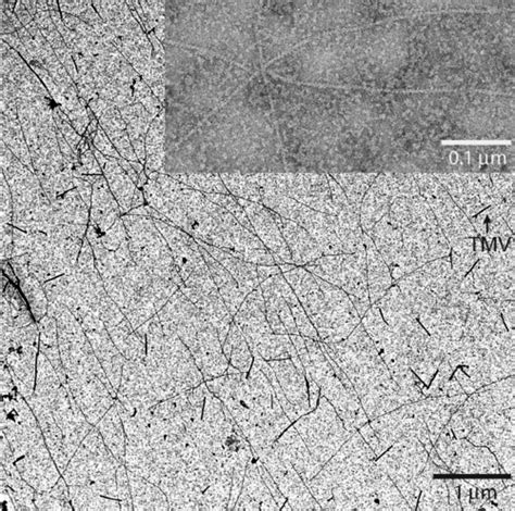 Electron Microscopy Electron Micrographs Of Negatively Stained Pf