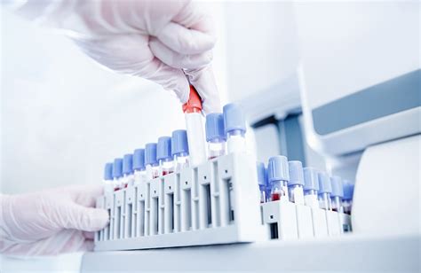 Dna Relationship Testing Genetrack India