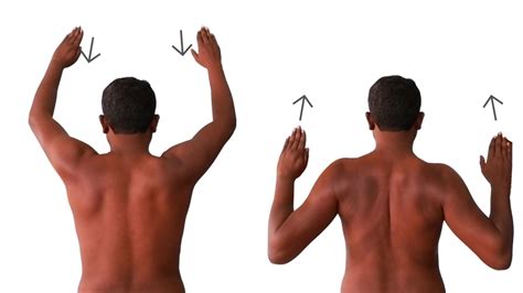 6 Super Effective Exercises To Correct Winging Of Scapula With Videos