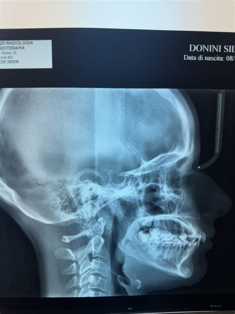 Molarclassnew Classification Dataset And Pre Trained Model By Ortofe1
