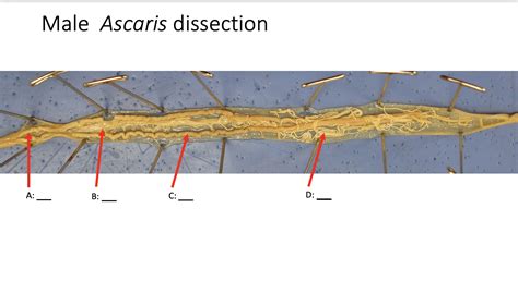 Solved Male Ascaris Dissection A B C D —