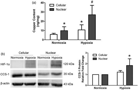 Featured Article Effect Of Copper On Nuclear Translocation Of Copper