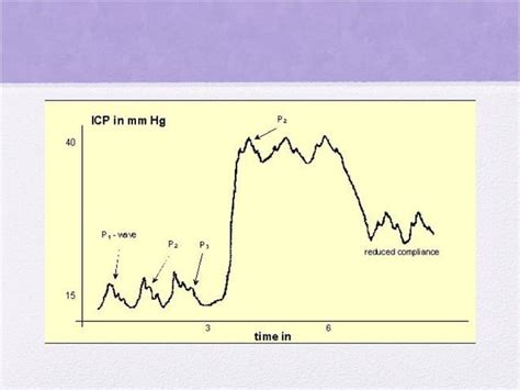 Neuromonitoring And Cerebral Protection Strategies Ppt First Aid