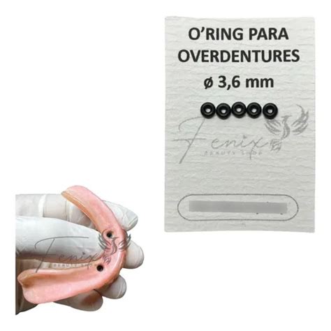 5 Unds Attachment Oring Implante Dentadura Overdenture Mercadolivre