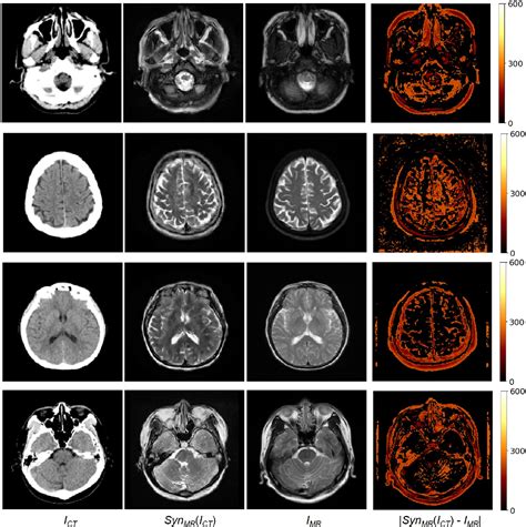 figure 5 from deep ct to mr synthesis using paired and unpaired data