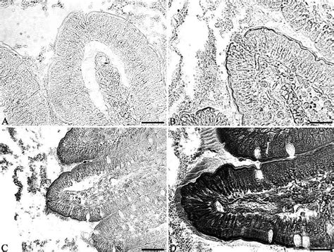 Light Microscopy Immunoperoxidase Staining Revealing Lipase In