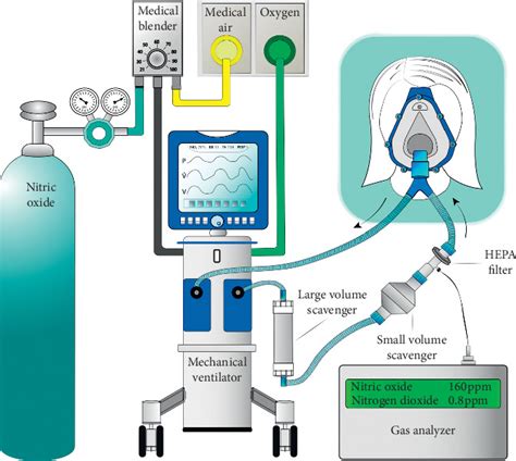 High Dose Inhaled Nitric Oxide As Adjunct Therapy In Cystic Fibrosis