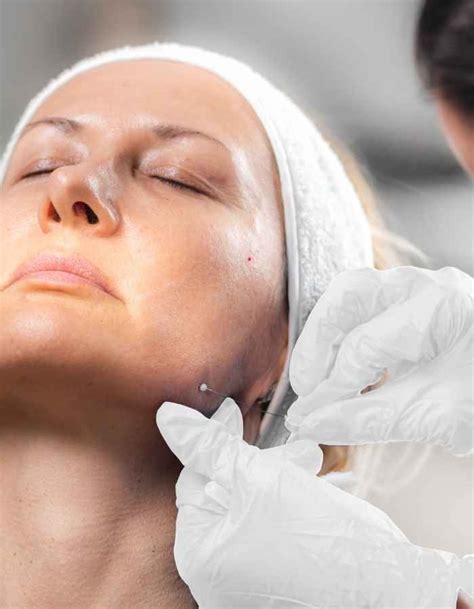 Pdo Threads — Troncones Med Spa